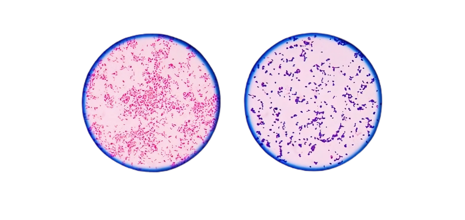 Gram stain test procedure: 10 Essential Tips for Success