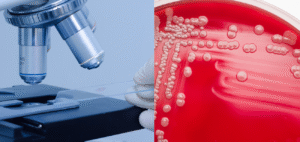 Gram Staining Protocol: 10 Essential Tips for Success