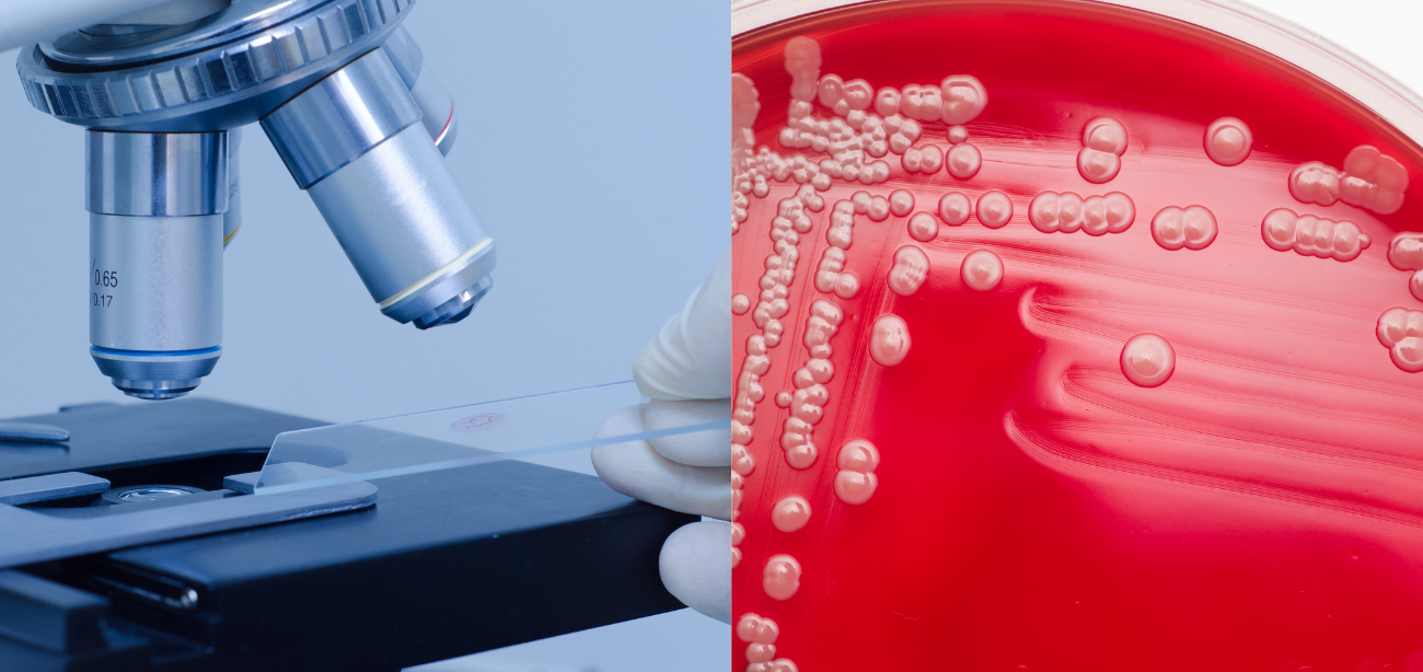 Gram stain test procedure: 10 Essential Tips for Success