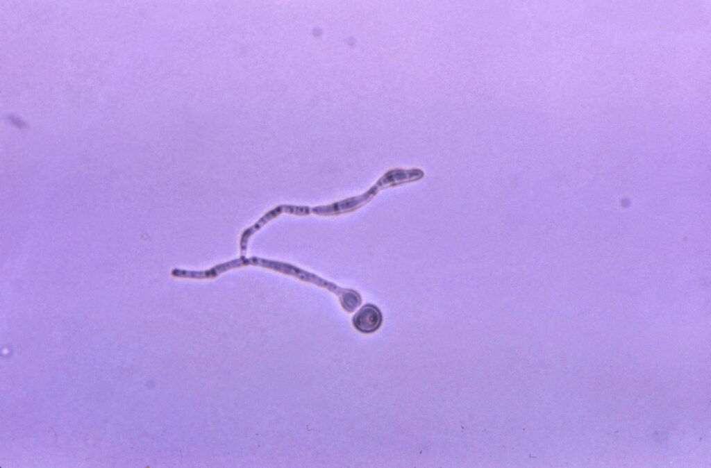 Germ Tube Test For Candida albicans