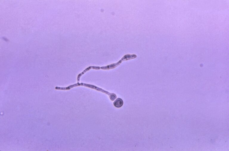 Germ Tube Test For Candida albicans