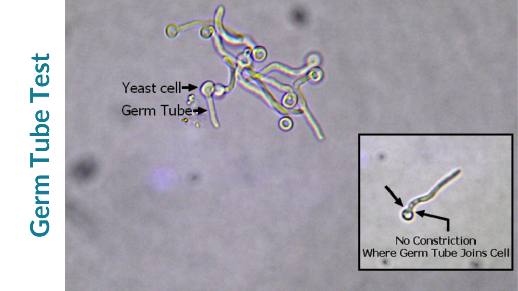 Germ Tube Test For Candida albicans