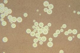 India Ink Stain - A Comprehensive Guide - Lab Test Academy