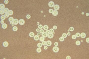 India Ink Stain - A Comprehensive Guide - Lab Test Academy