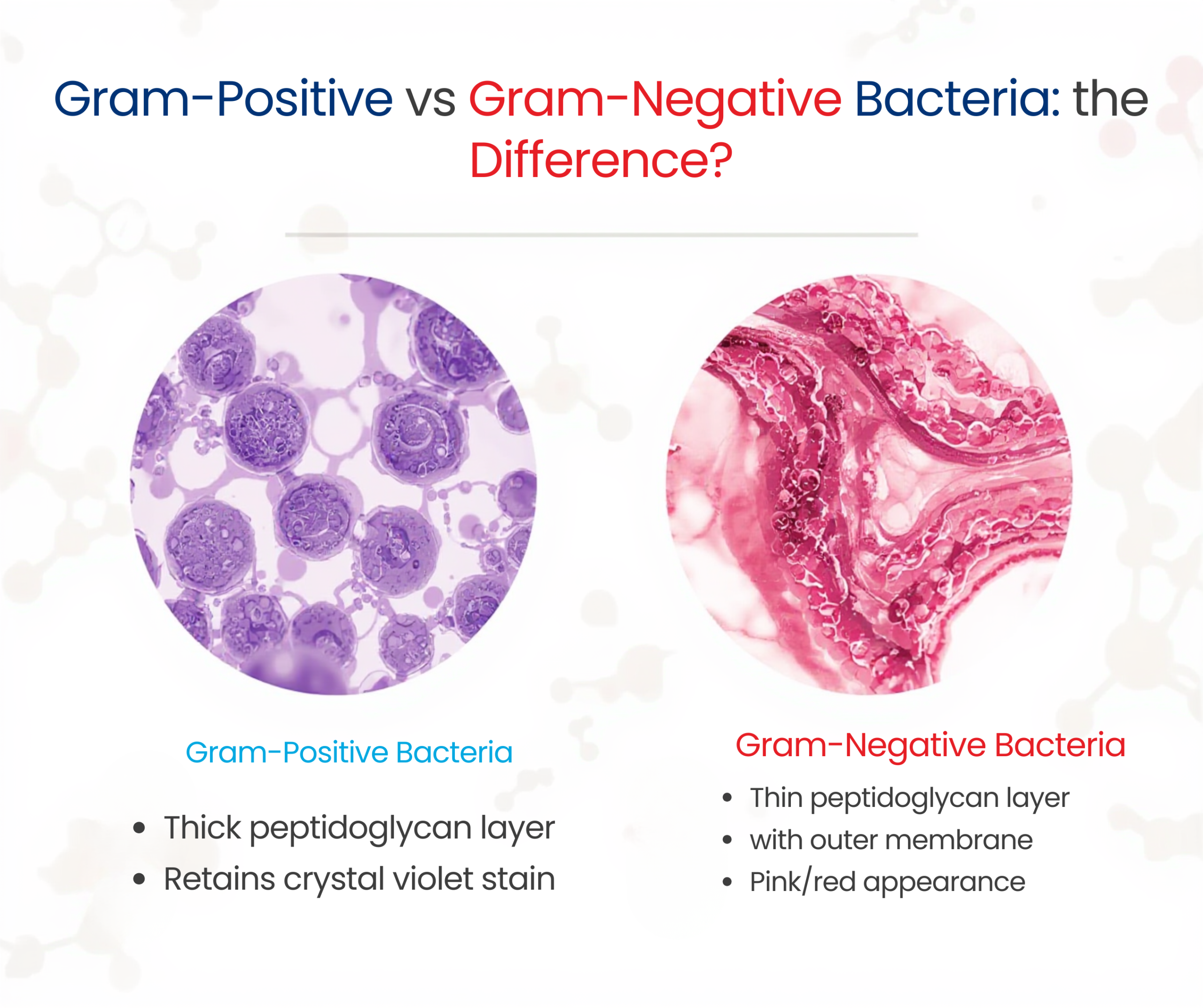 Gram-Positive Bacteria And Gram-Negative Bacteria Identification - Lab ...